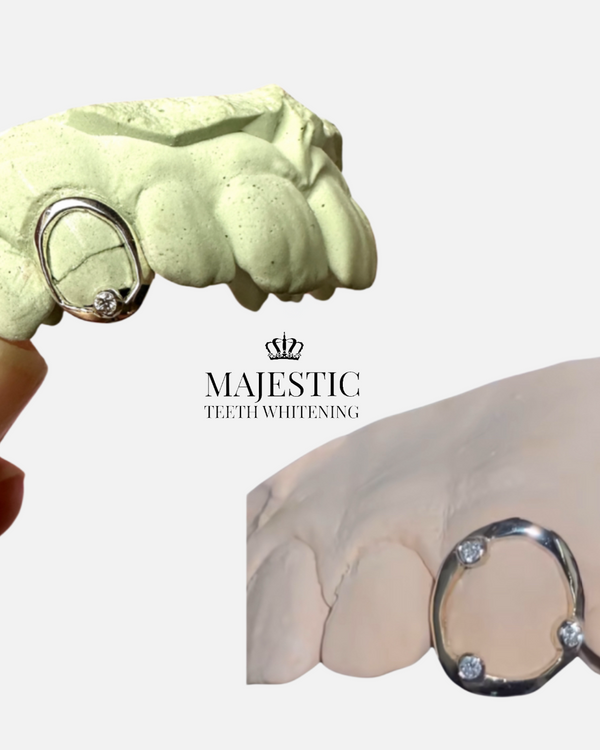 Single Window Cap with Stone- Grillz – Majestic Teeth Whitening
