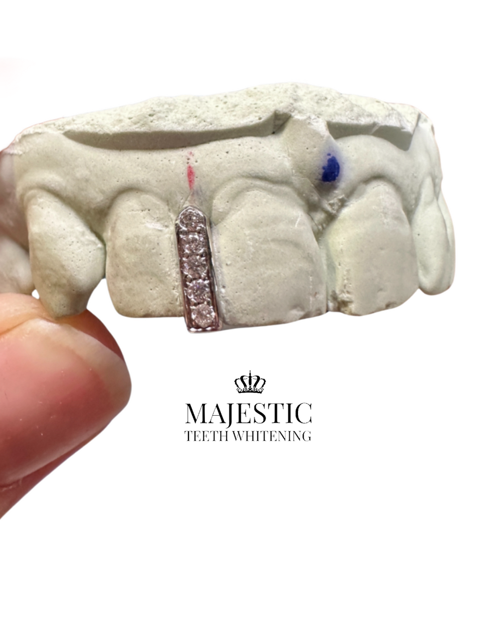 Iced Gap Filler Bar- Grillz – Majestic Teeth Whitening